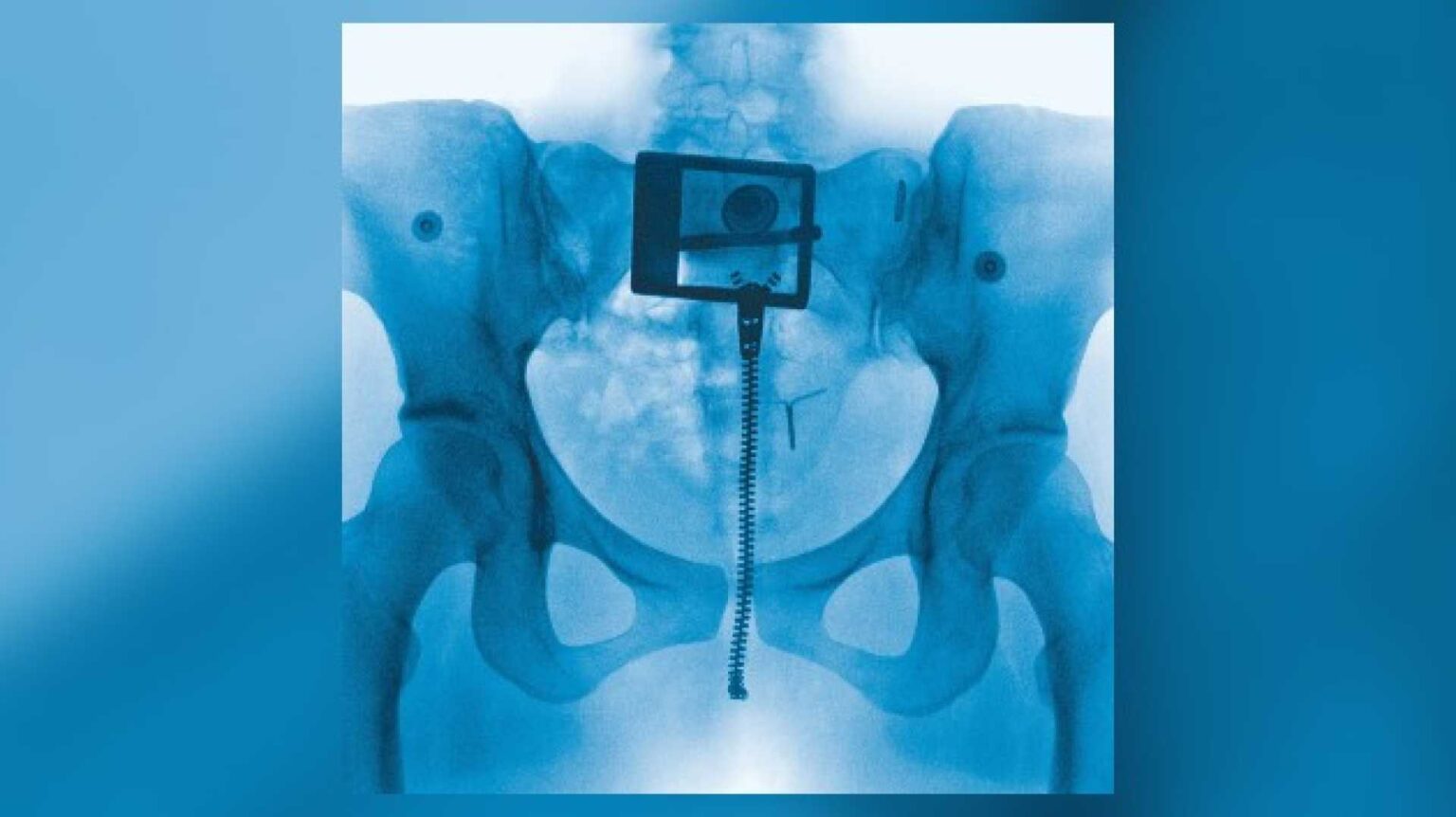 Lorde Announces Release Date for New Album 'Virgin' - Times News Global